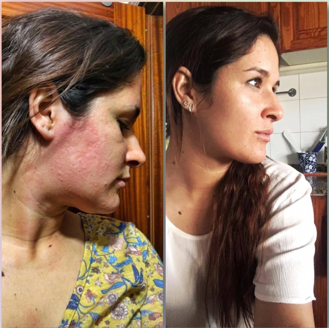 ¿Cómo puedo saber si soy intolerante al gluten? | Como Cocinar y Comer