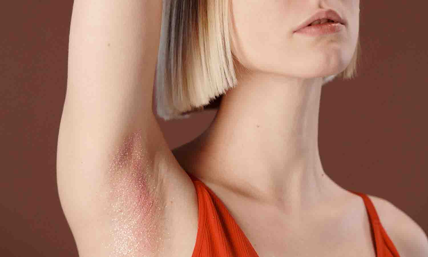 ¿Por qué se pone negra la axila? | Como Cocinar y Comer